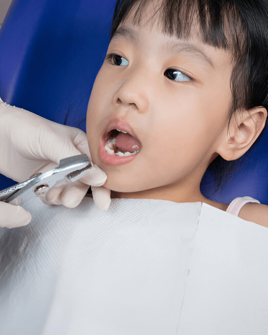 Tooth Extraction for Kids near Harris County, Texas - Stagecoach